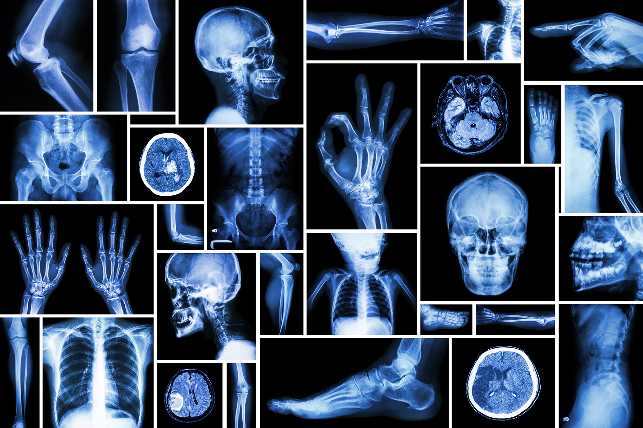 Medical Diagnosis | Diagnostic Health Services | Briz Brain & Spine