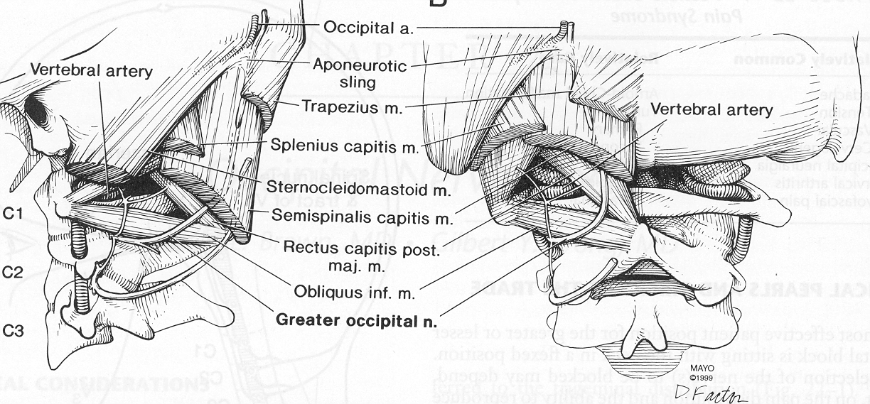 Case Study: Occipital Neuralgia - Briz Brain & Spine